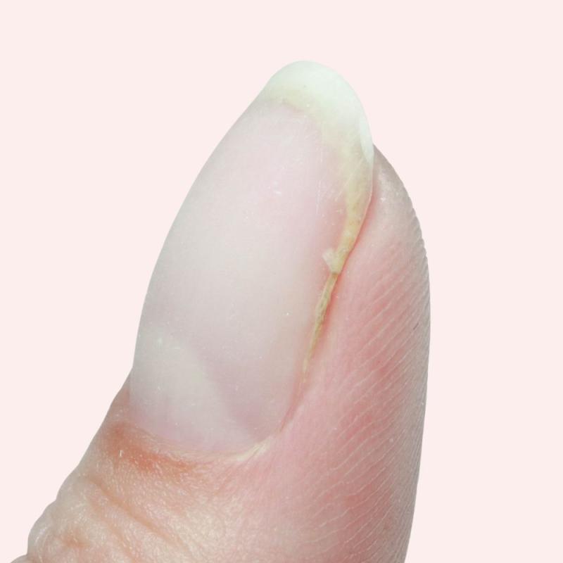 How to Fix a Broken Nail: We Show You How in 5 Ways!