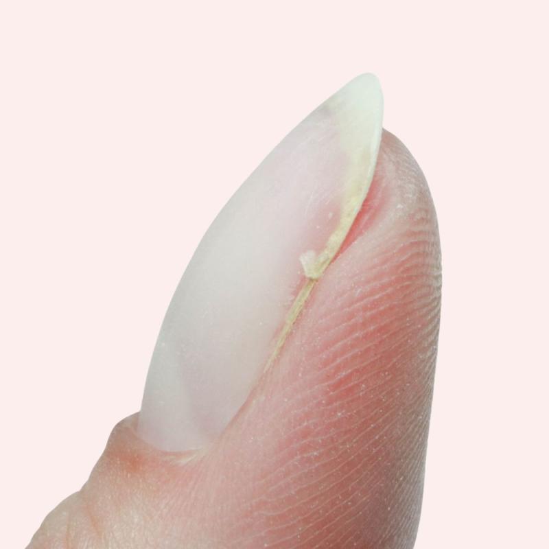 How to Fix a Broken Nail: We Show You How in 5 Ways!